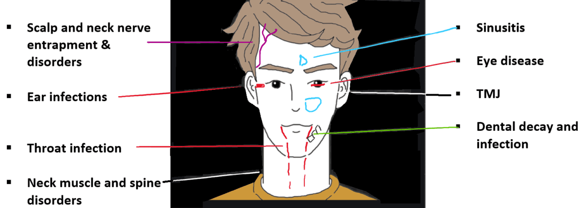 Headache Serious and Red flags that Requires Immediate Attention.